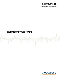 Aloka Arietta 70 Ultrasound | Surgical Equipment Rental